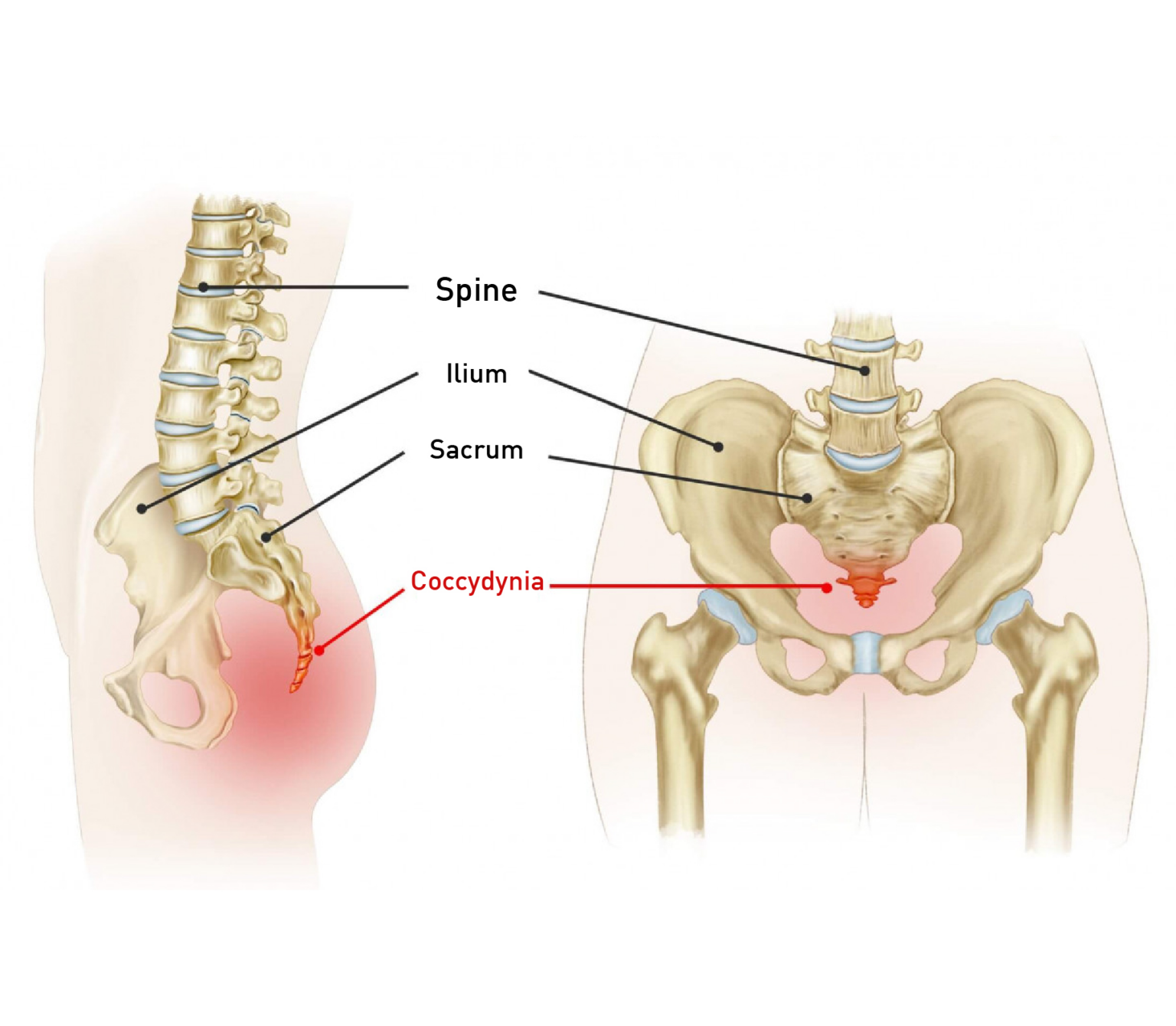 Coccydynia – Lymph & Pelvic Care